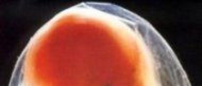 La Comisión Nacional de Bioética reconoce que el «nasciturus» es un ser ...